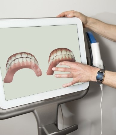 Orthodontic Technology Houston, TX | iTero Scanner | Hall Orthodontics ...